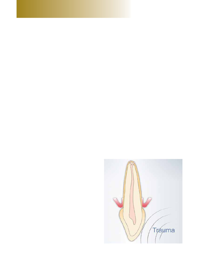 Single Vital Tooth Whitening | PDF | Human Tooth | Dentin