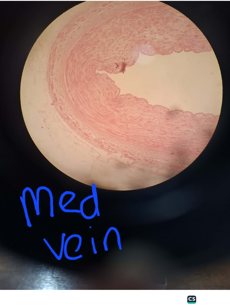 CVS Histo Slides | PDF