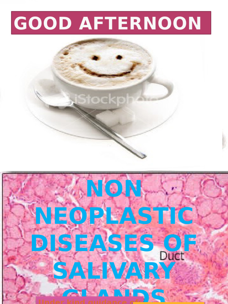 Non-Neoplastic Salivary Gland Diseases | PDF | Immune System | Human ...