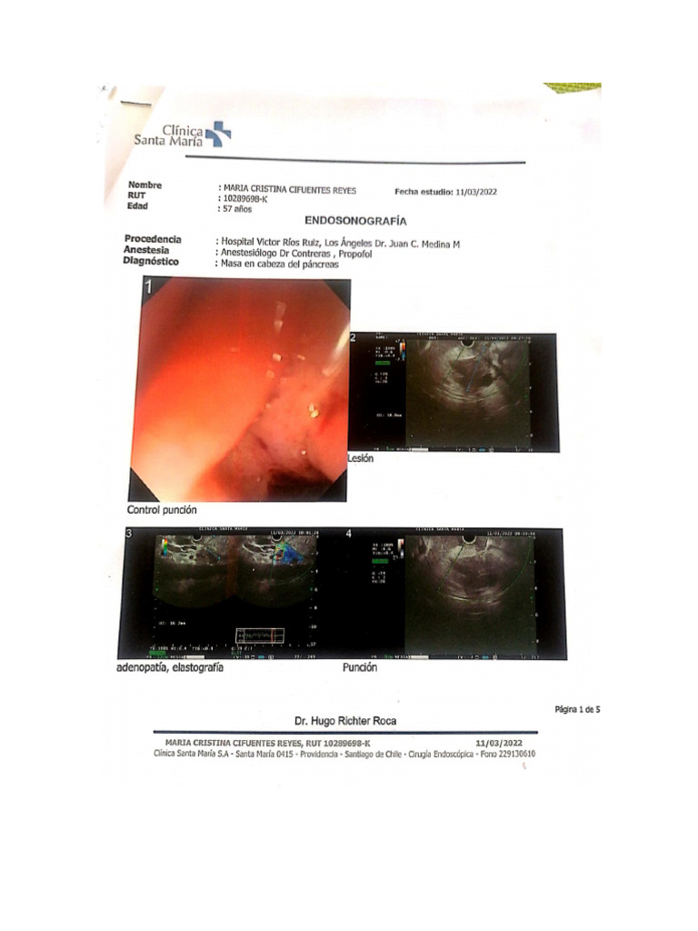 Endosonografia 03.22 | PDF