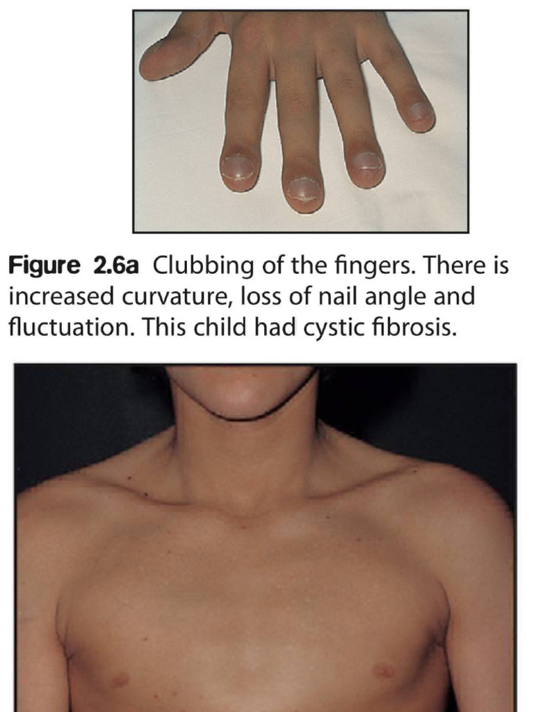 Illustrated Photos | PDF | Cutaneous Conditions | Dermatology