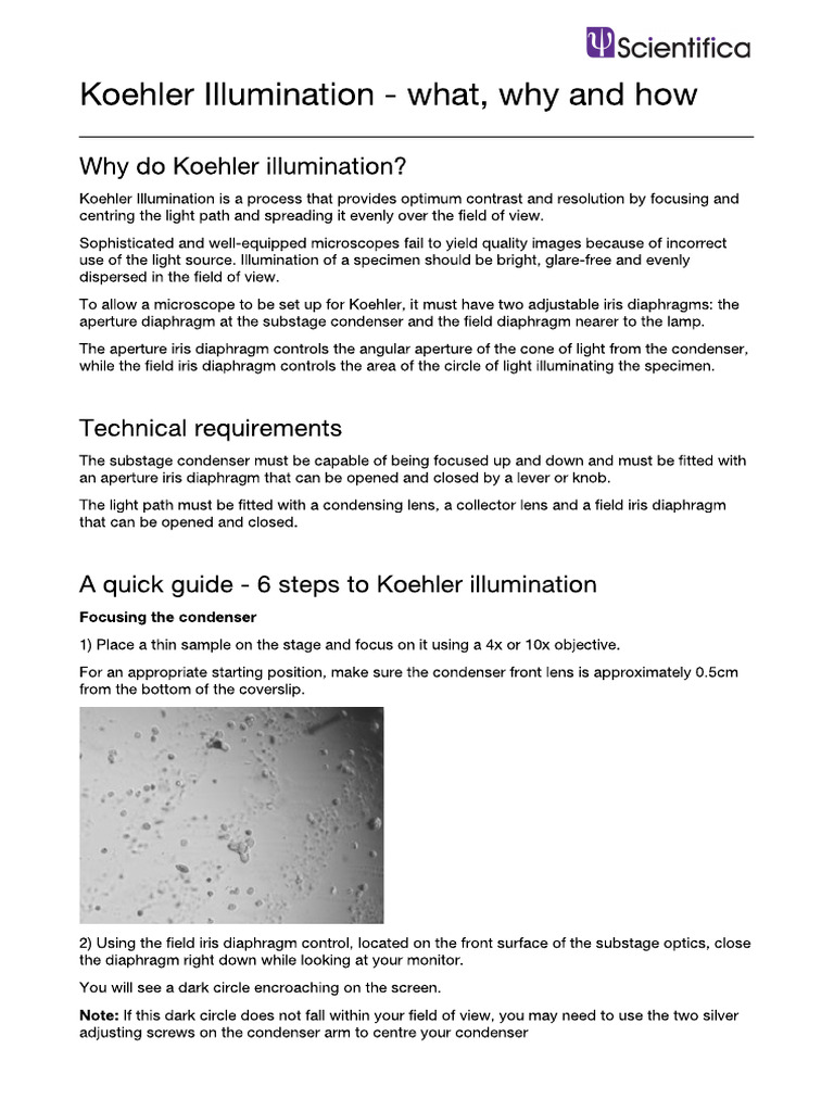 6 Step Guide To Koehler Illumination | PDF