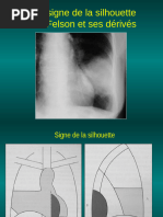 Sémiologie radiologique du syndrome bronchique | PDF | Poumon ...