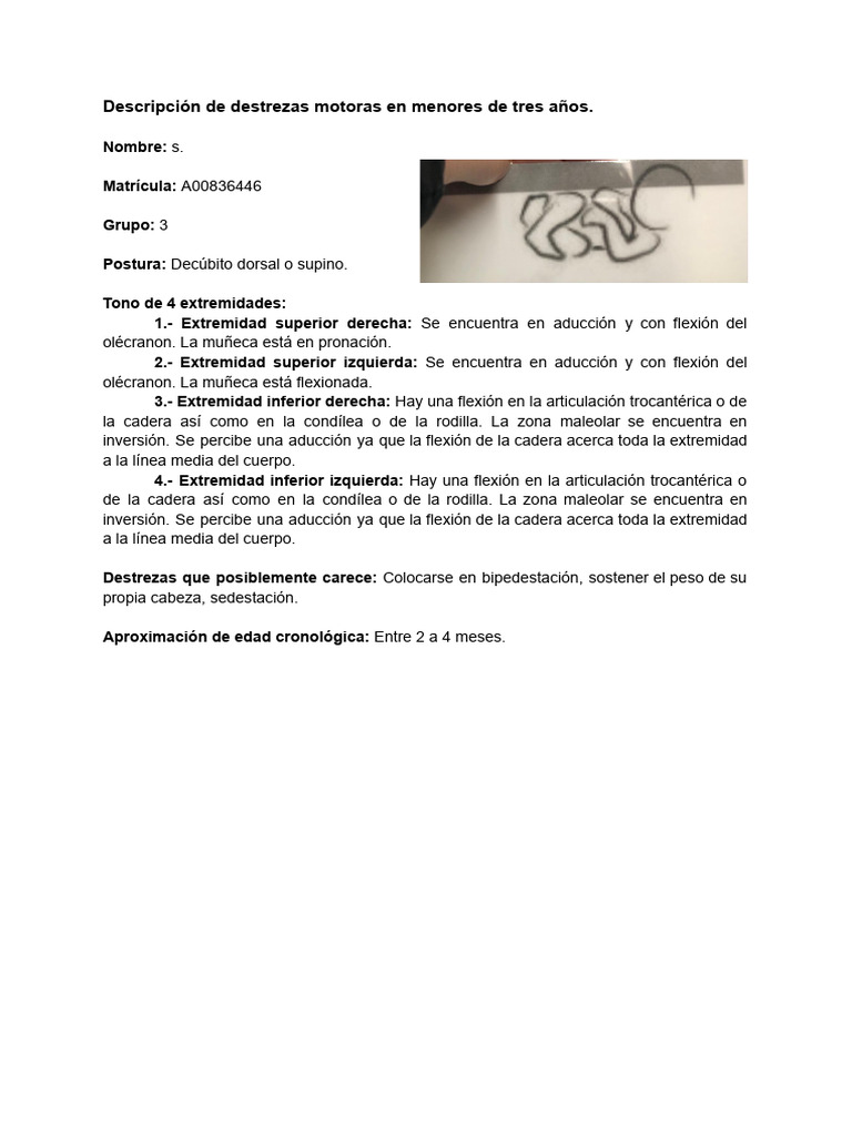 Descripción de Destrezas Motoras en Menores de Tres Años | PDF