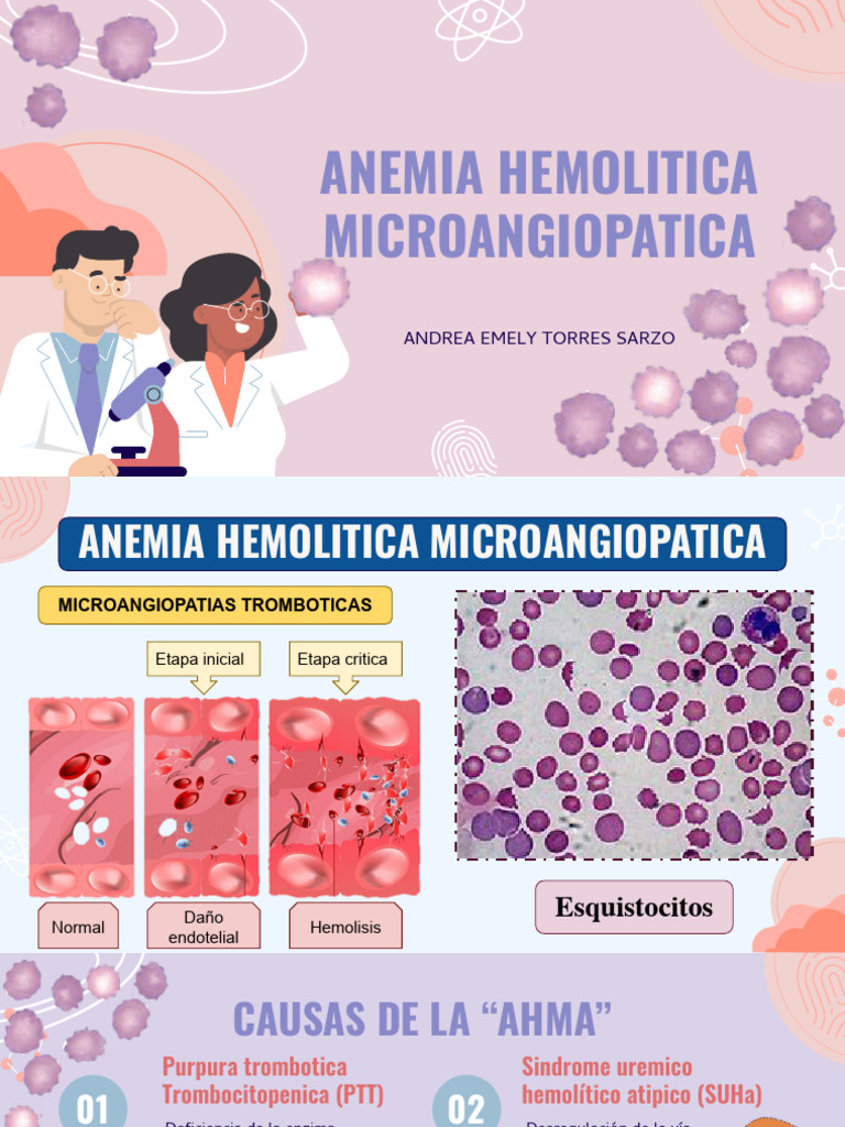 Amemia Hemolitica Microangiopatica | PDF | Enfermedades y trastornos ...