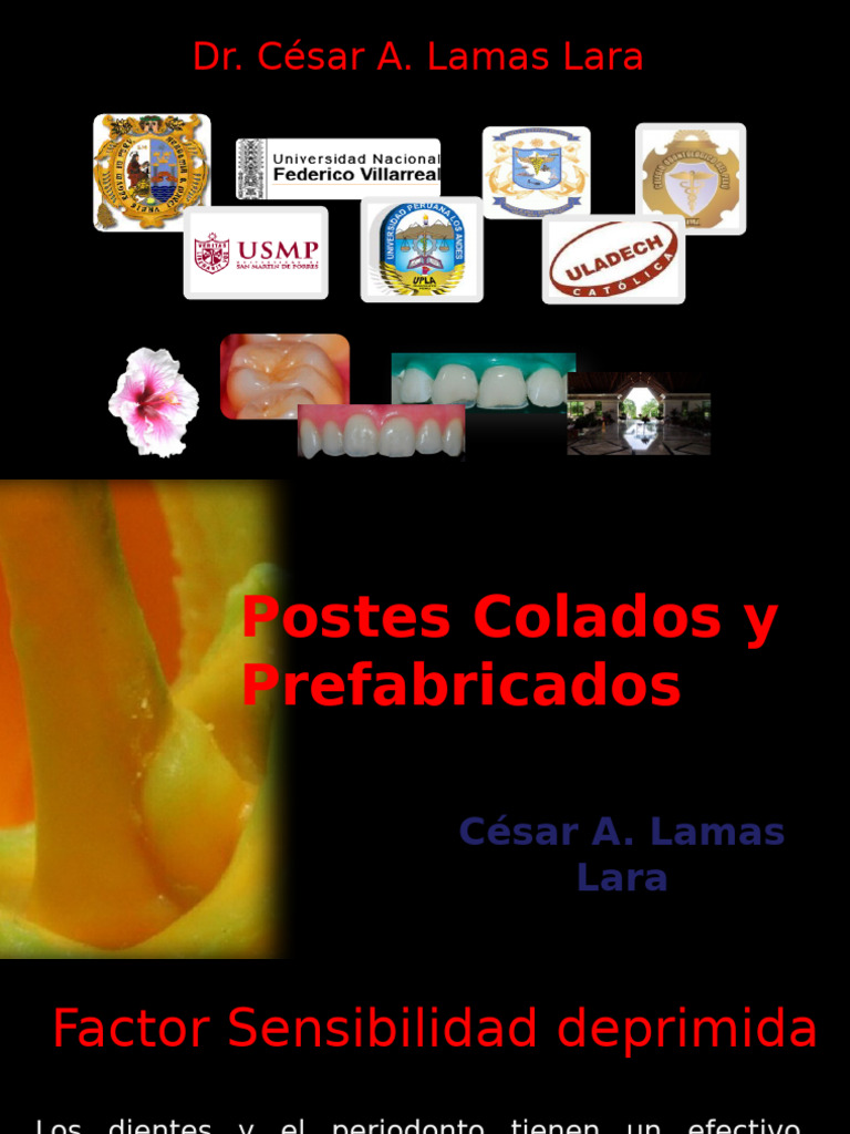 Postes Colados y Prefabricados en Odontología | PDF | Adhesión | Aleación