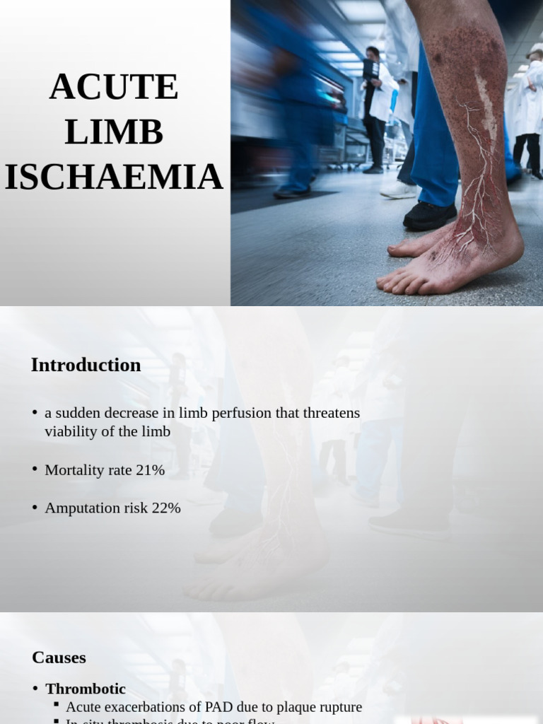 Acute Limb Ischemia | PDF