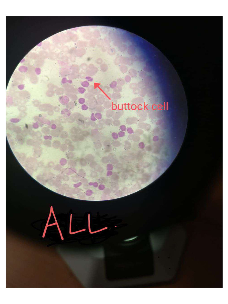 Histopath PDF Compressed | PDF