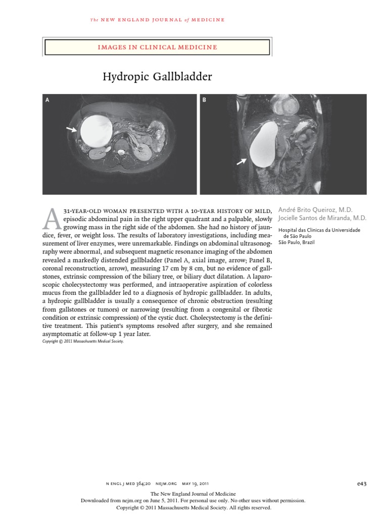 NEJMi - Hydropic Gallbladder | PDF