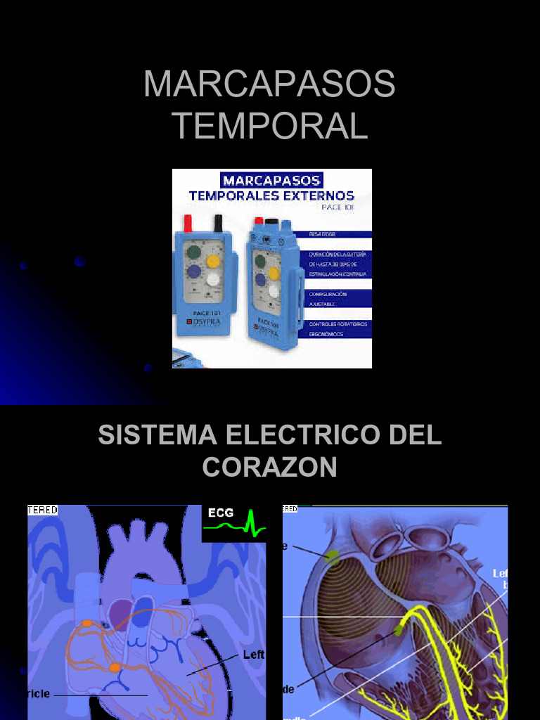 Marcapasos Temporal: Uso y Cuidados | PDF
