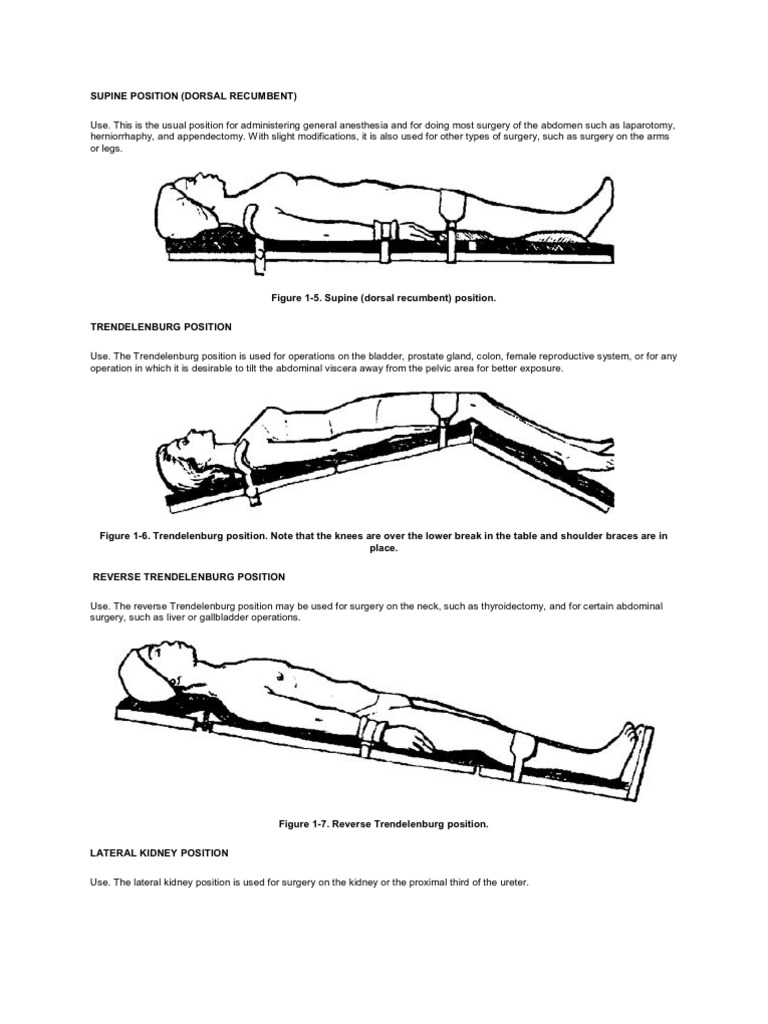 Reverse Trendelenburg Position