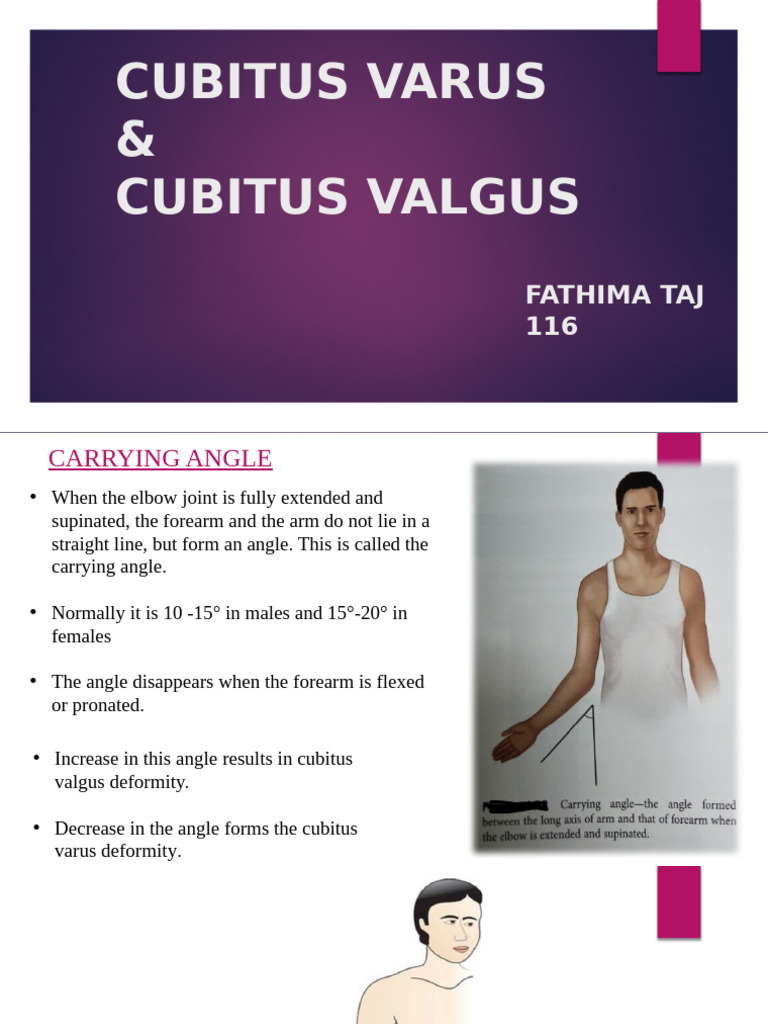 Understanding Cubitus Valgus Deformity | PDF | Elbow | Musculoskeletal ...