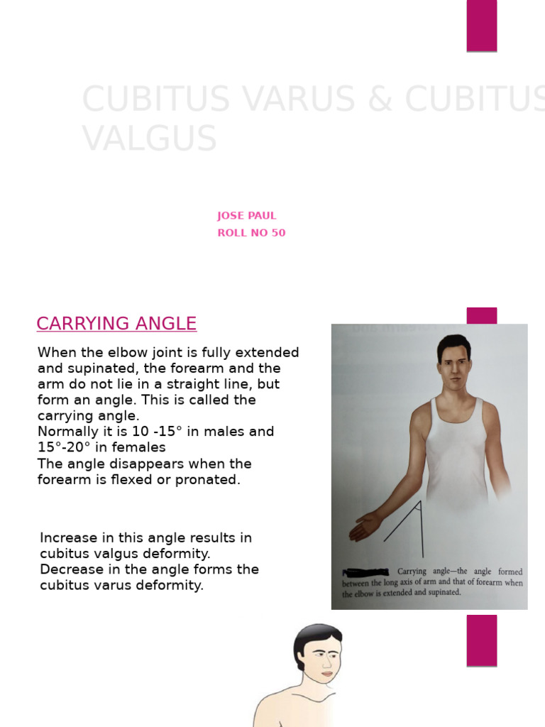 Cubitus Varus & Valgus Final | PDF | Elbow | Human Anatomy