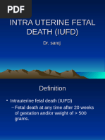 IUFD | PDF | Childbirth | Fetus