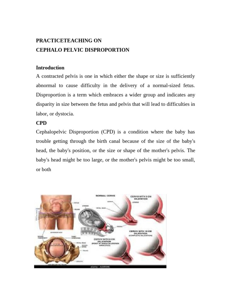 Practiceteaching on Cpd | PDF | Pelvis | Childbirth