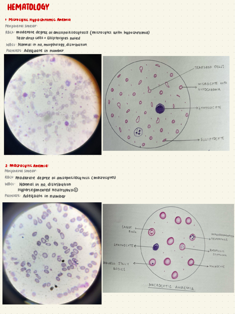 Pathology 3rd Internals | PDF | Epithelium | Anemia