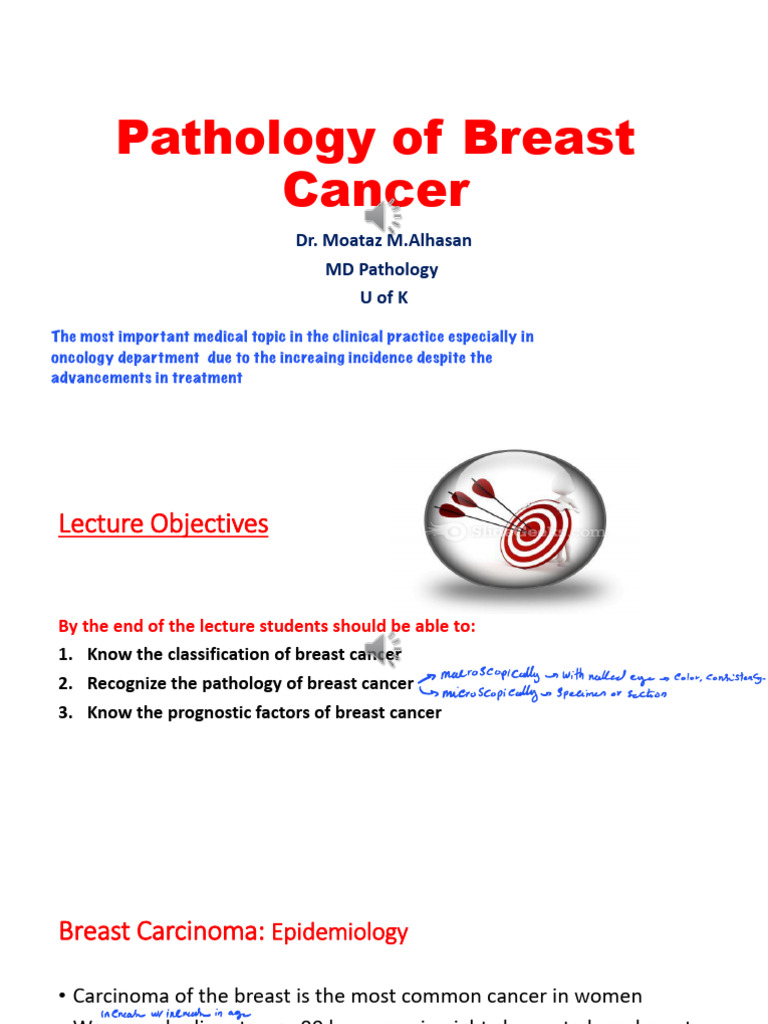 L20 Pathology of Breast Cancer-1 | PDF | Carcinoma | Metastasis