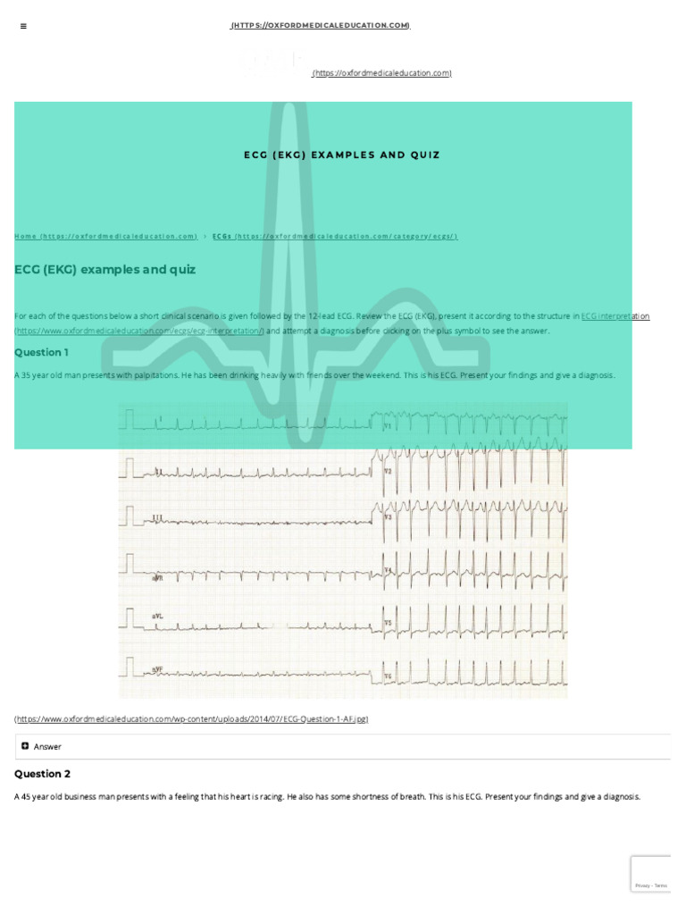 ECG (EKG) Examples and Quiz - Oxford Medical Education | PDF | Diseases ...