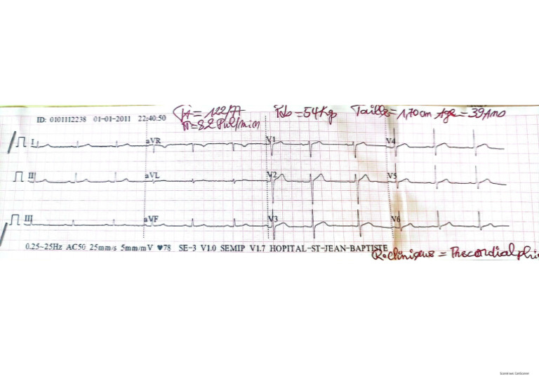 Sawadogo Yacouba | PDF