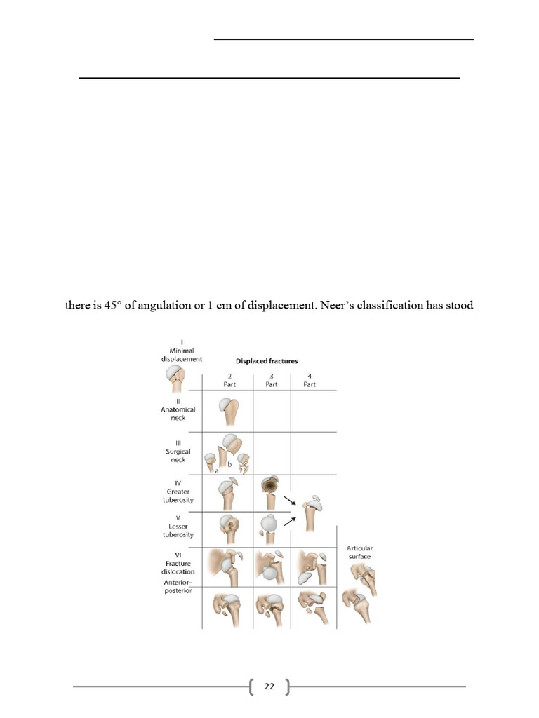 Shoulder Injury Classification Review | PDF | Shoulder | Joints