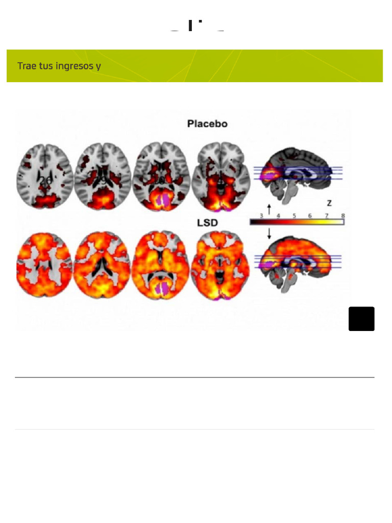 Efectos del LSD en el cerebro humano | PDF | Neurociencia
