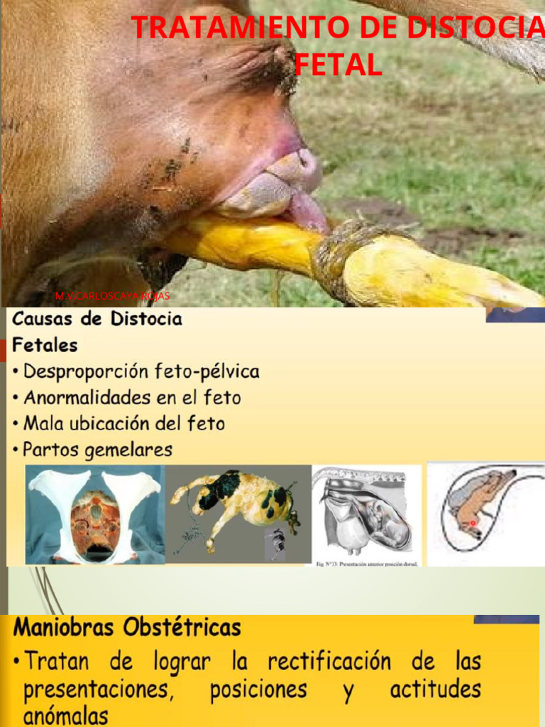 15 Semana Distocia Fetal 1.pdf - 20241211 - 110531 - 0000 | PDF