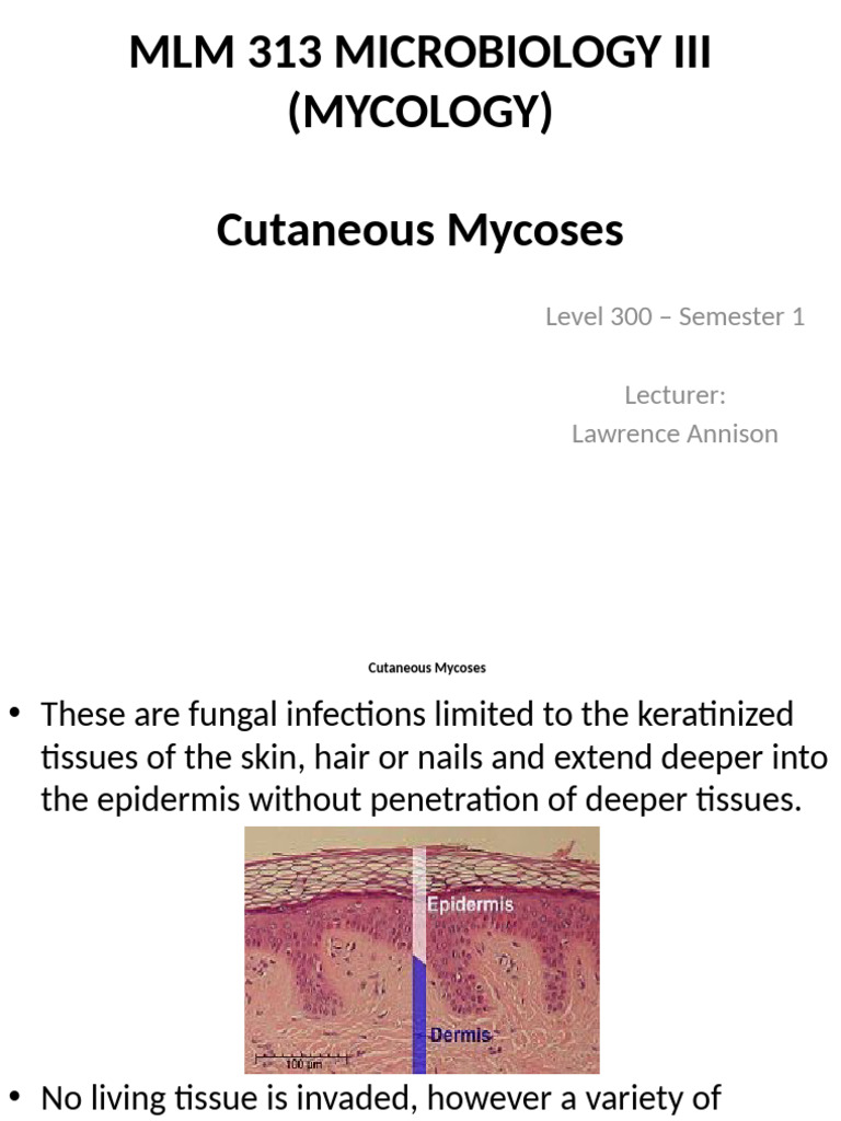 Understanding Cutaneous Mycoses: Tinea Infections | PDF | Diseases And ...