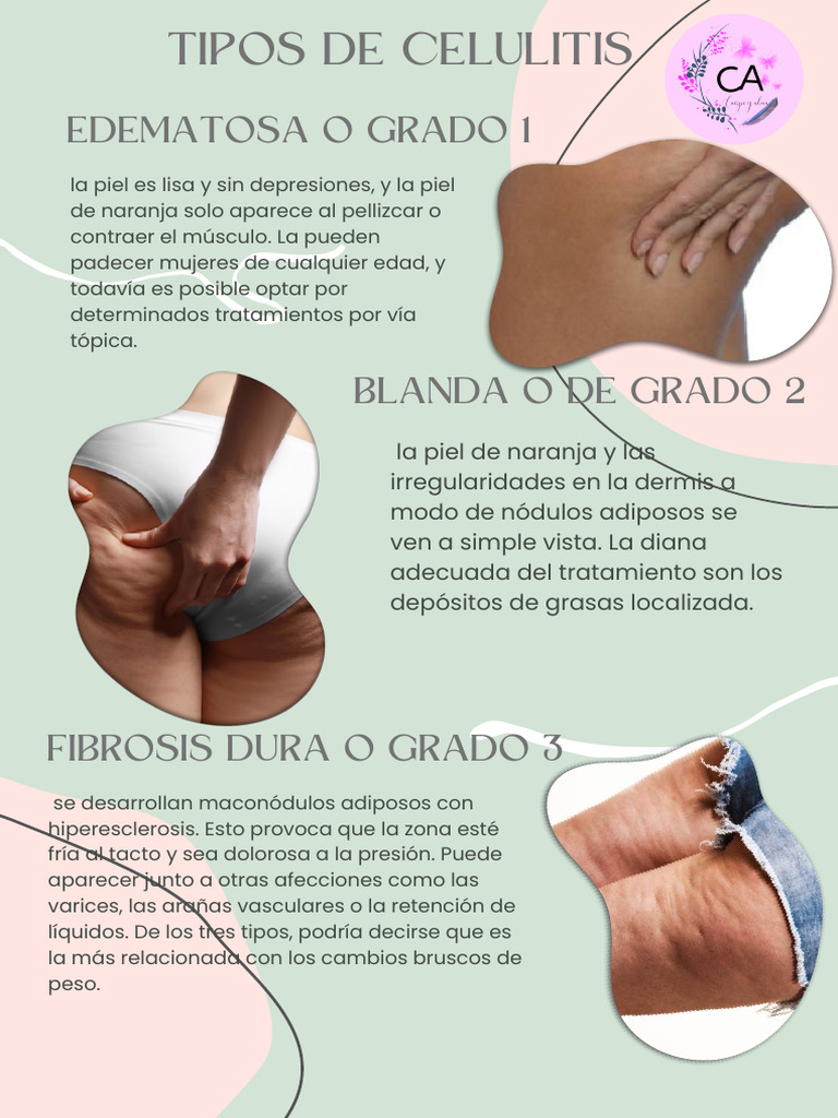 Tipos de Celulitis y Tratamientos | PDF