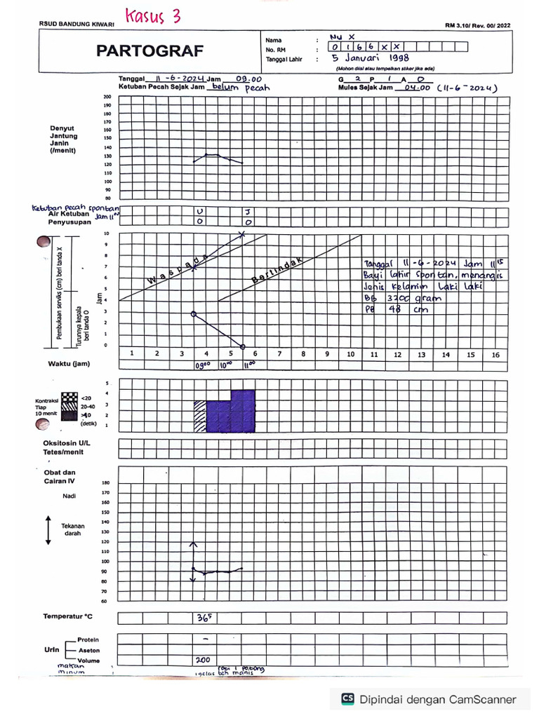 Partograf Kasus 3 NY X | PDF