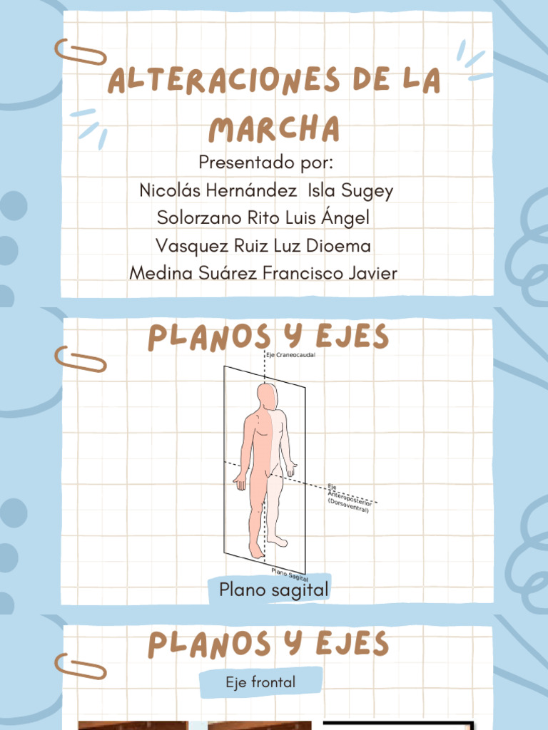 Clasificación de Alteraciones de la Marcha | PDF | Pie | Tobillo