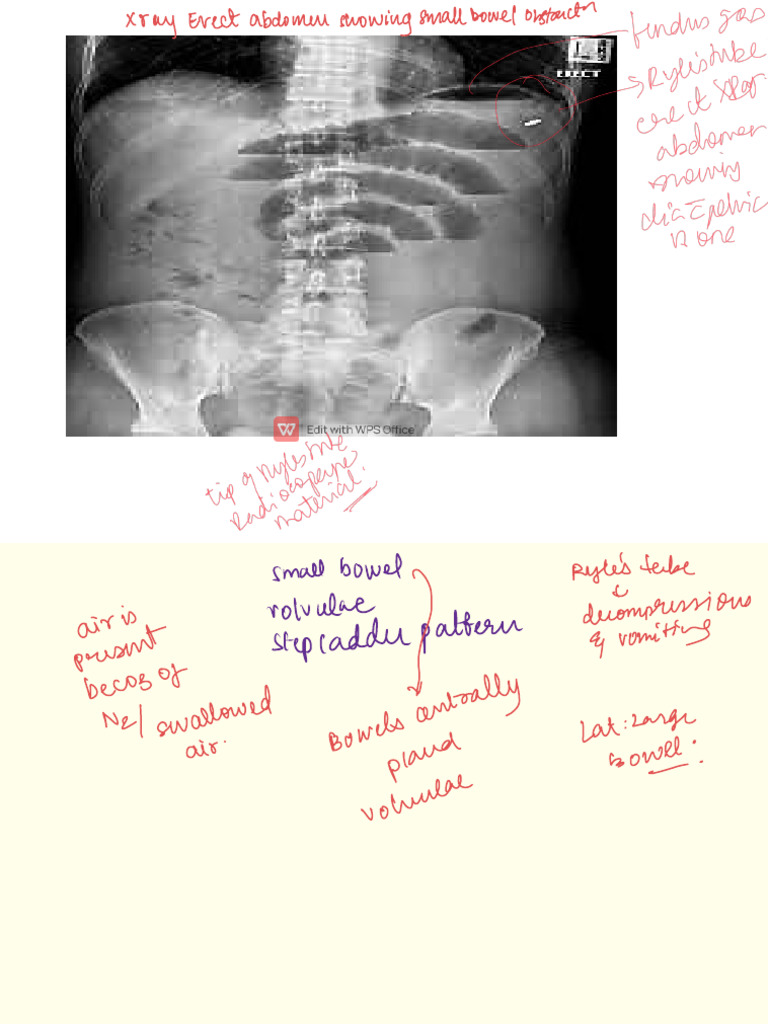 _final x rays.pdf | PDF