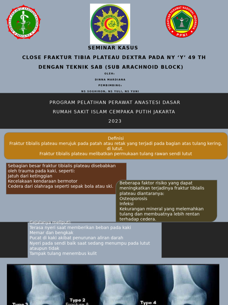 PPT CF TIBIA PLATEAU 20230723115001 | PDF