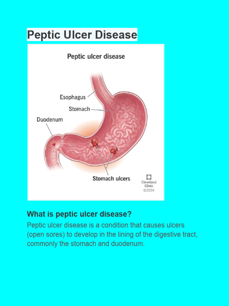 CME Lecture On Peptic Ulcer Disease | PDF | Stomach | Indigestion