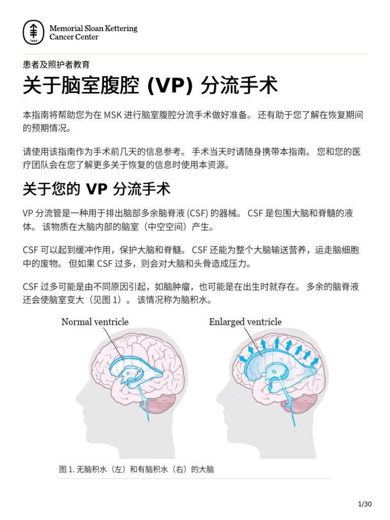 About Your Ventriculoperitoneal VP Shunt Surgery | PDF