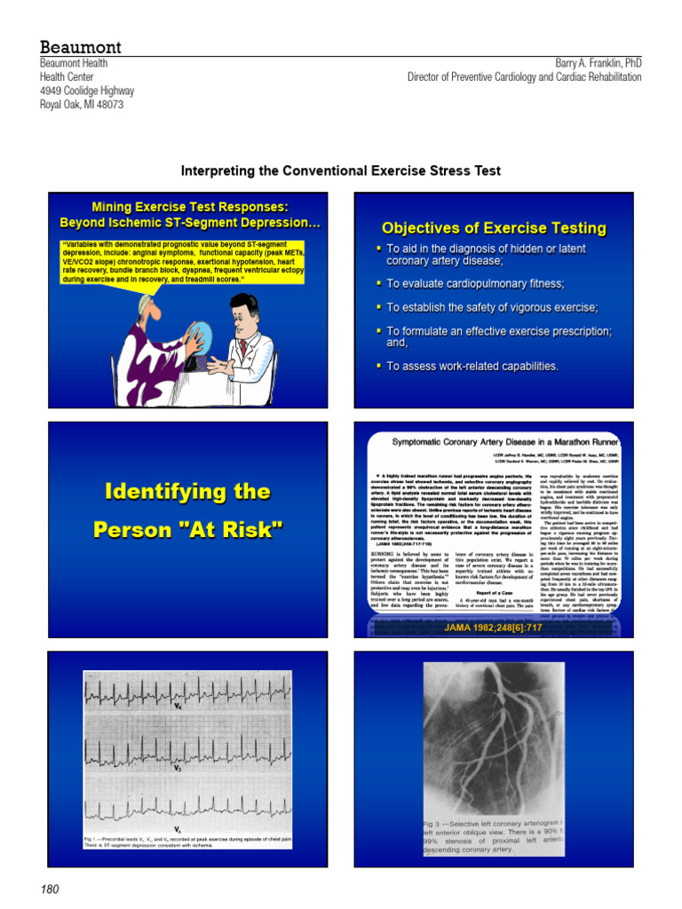 Interpreting Stress Test | PDF | Myocardial Infarction | Coronary ...