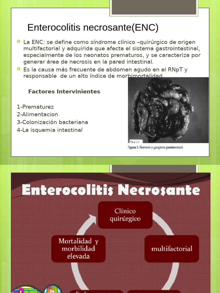 Enterocolitis Necrotizante | PDF | Diarrea | Especialidades Medicas