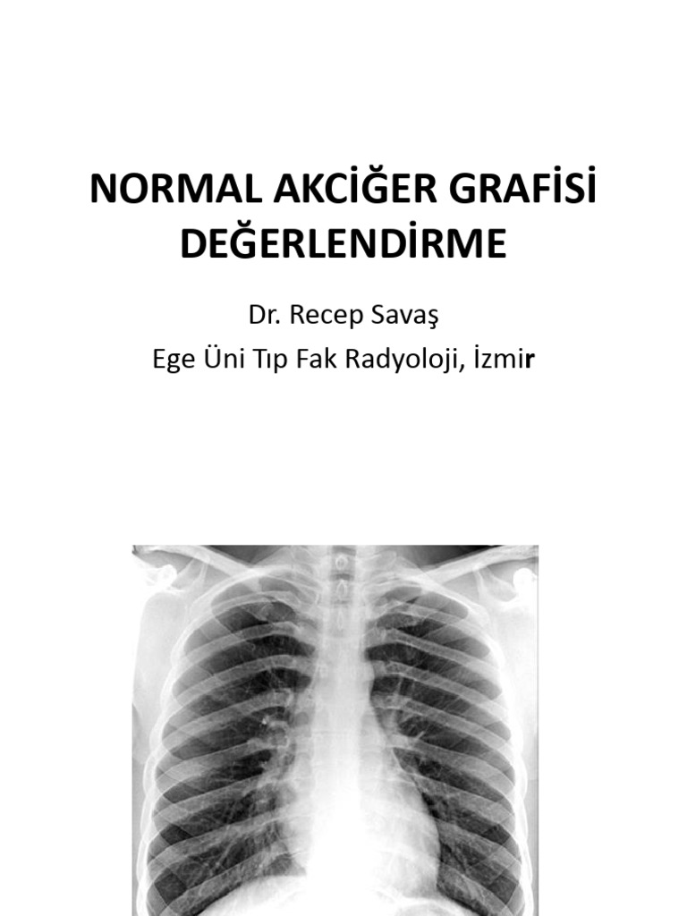 Normal Akciger Grafisi DR Recep Savas | PDF