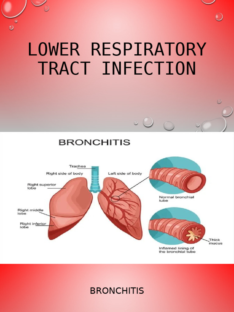 Lower respiratory tract infection | PDF | Bronchitis | Cough