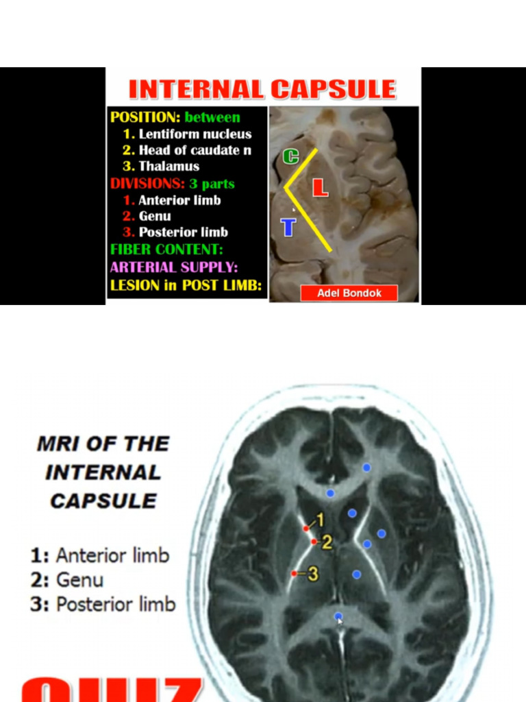 Internal Capsule | PDF