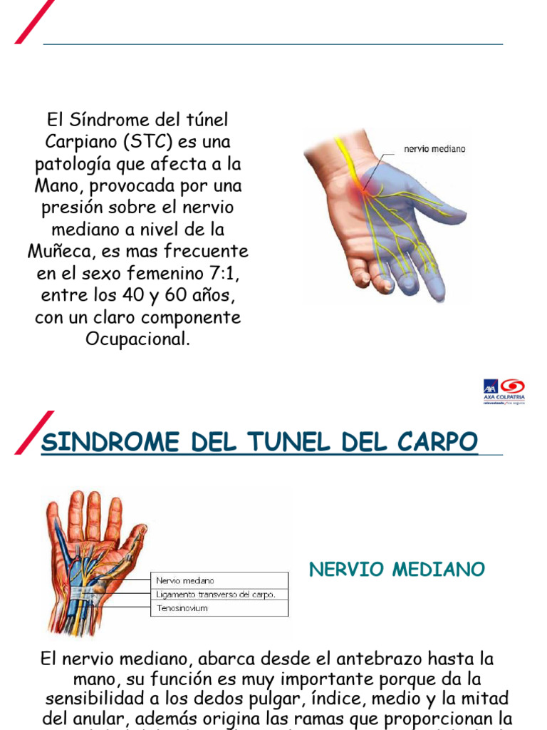 Taller I | PDF | Síndrome del túnel carpiano | Especialidades Medicas