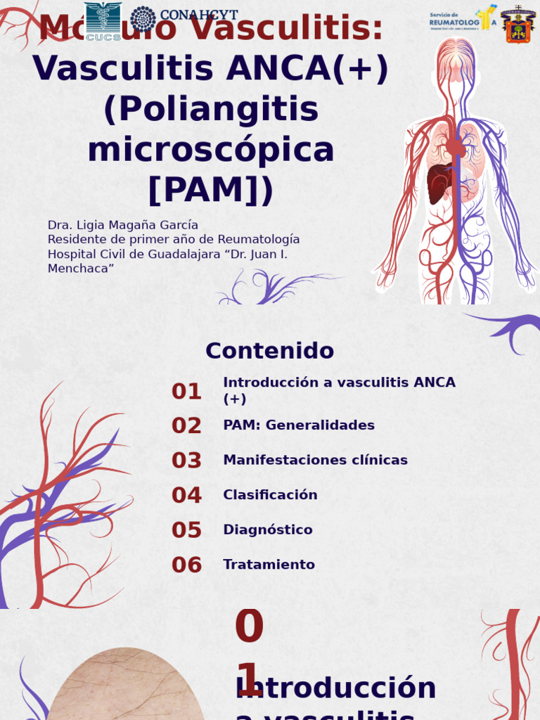 Vasculitis ANCA(+) y Poliangitis Microscópica | PDF | Diagnostico ...