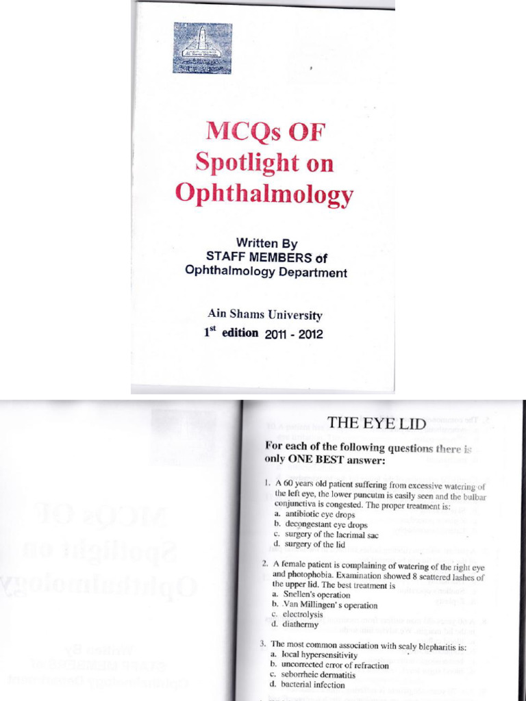 MCQ of Spotlight On Ophthalmology | PDF