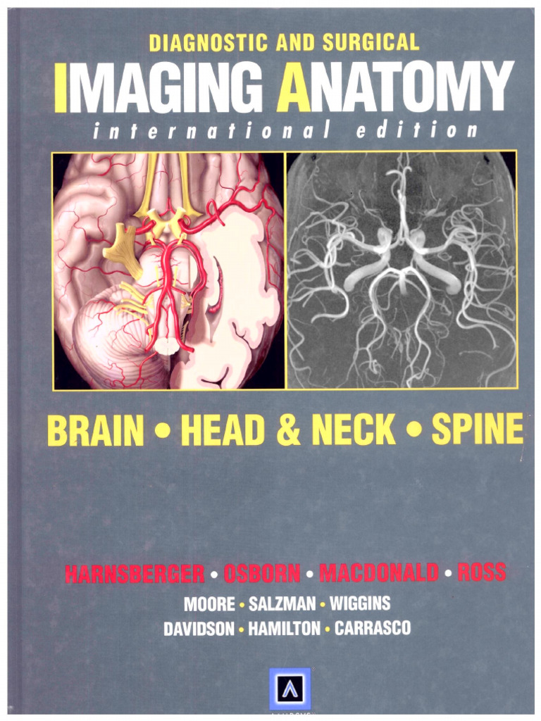 Diagnostic Imaging Anatomy Brain, Head-Neck and Spine | PDF
