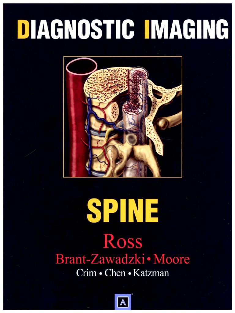 Diagnostic Imaging Spine | PDF