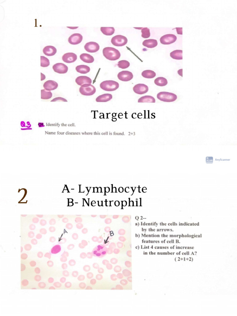 Pathology OSPE Slides | PDF