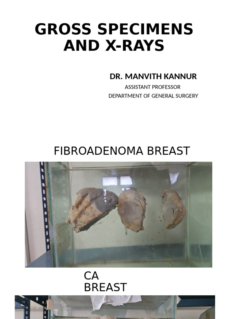 Gross Specimens and X Rays | PDF
