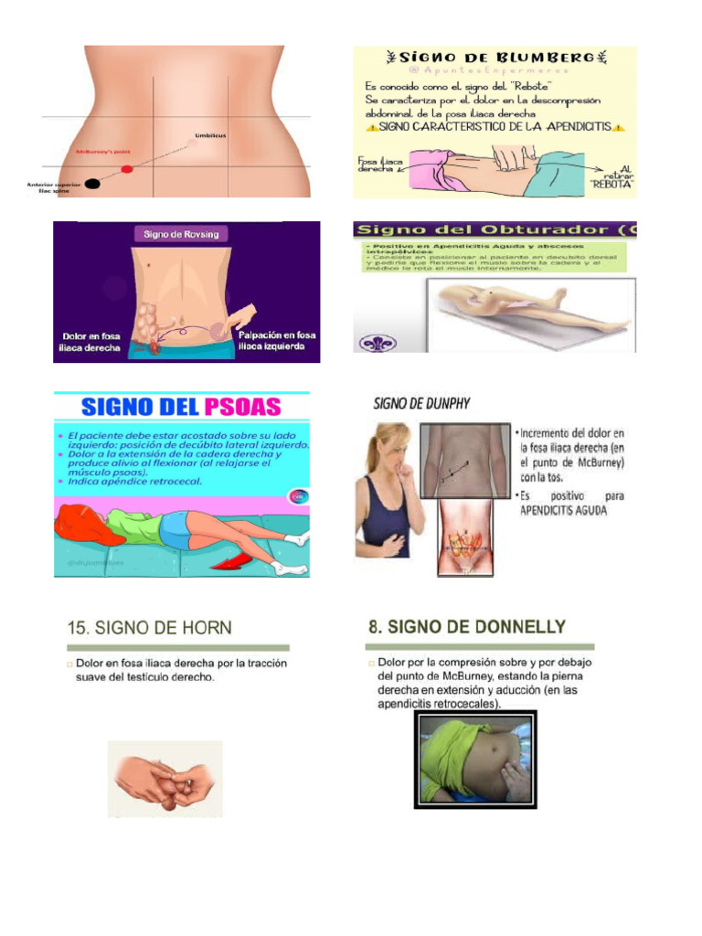 imagenes signos de apendicitis | PDF