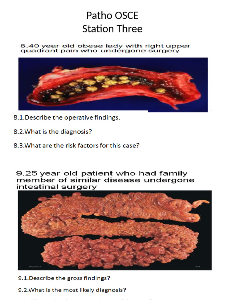 Patho OSCE GIT 3 | PDF