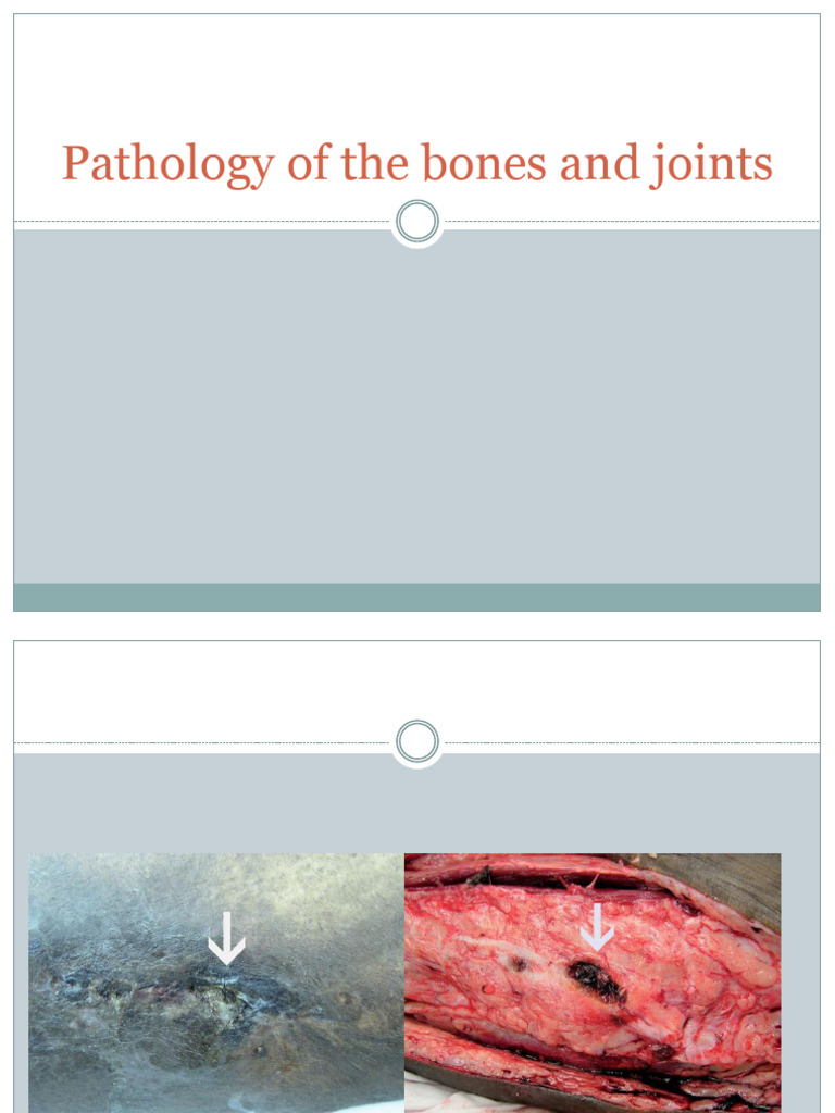 Chapter 19 Pathology of The Bones and Joints | PDF