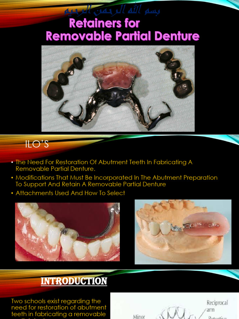 Retainers For Removable Partial Denture 23 | PDF | Dentures | Medical ...